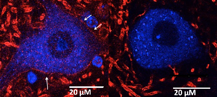 Alvarez Laboratory - Emory SOM - Cell Biology